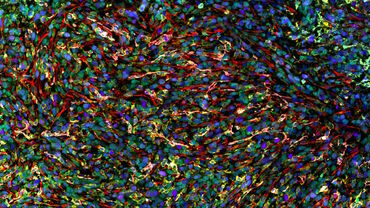 Aivia AI Image Analysis Software - Applications | Products | Leica ...