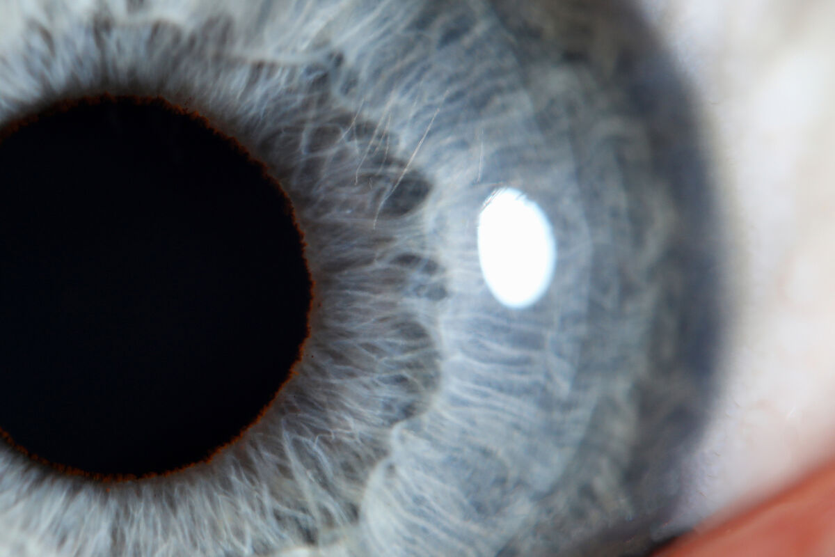 Clinical Symposium on OCT-guided Cornea Surgery | Learn & Share | Leica ...