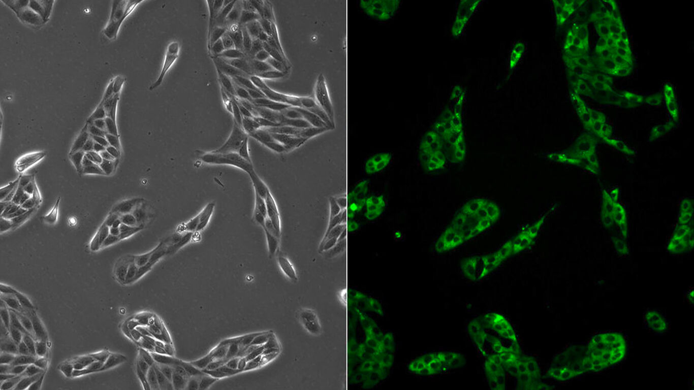 Life Science Research | Applications | Leica Microsystems