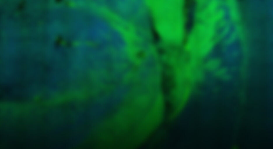 STELLARIS CRS Coherent Raman Scattering Microscope | Products | Leica ...