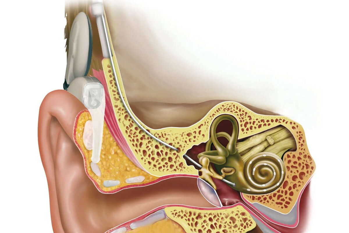 Cochlea Ear
