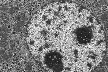 Epoxy Resin Embedding of Animal and Human Tissues for Pathological ...
