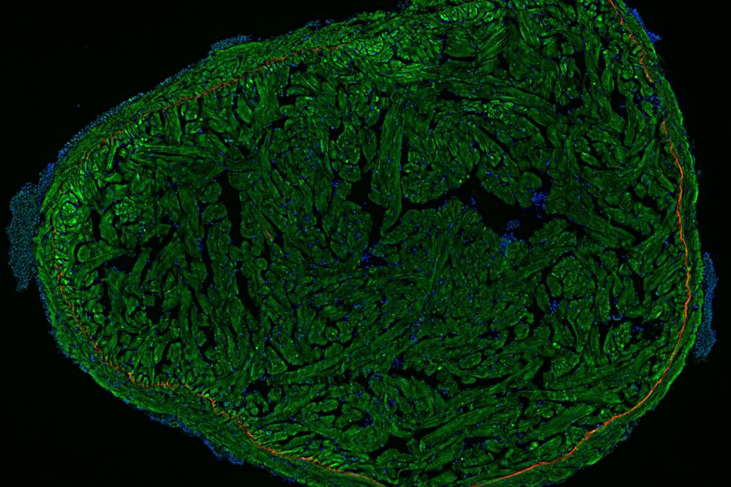 A Guide to Fluorescence Microscopy | Learn & Share | Leica Microsystems