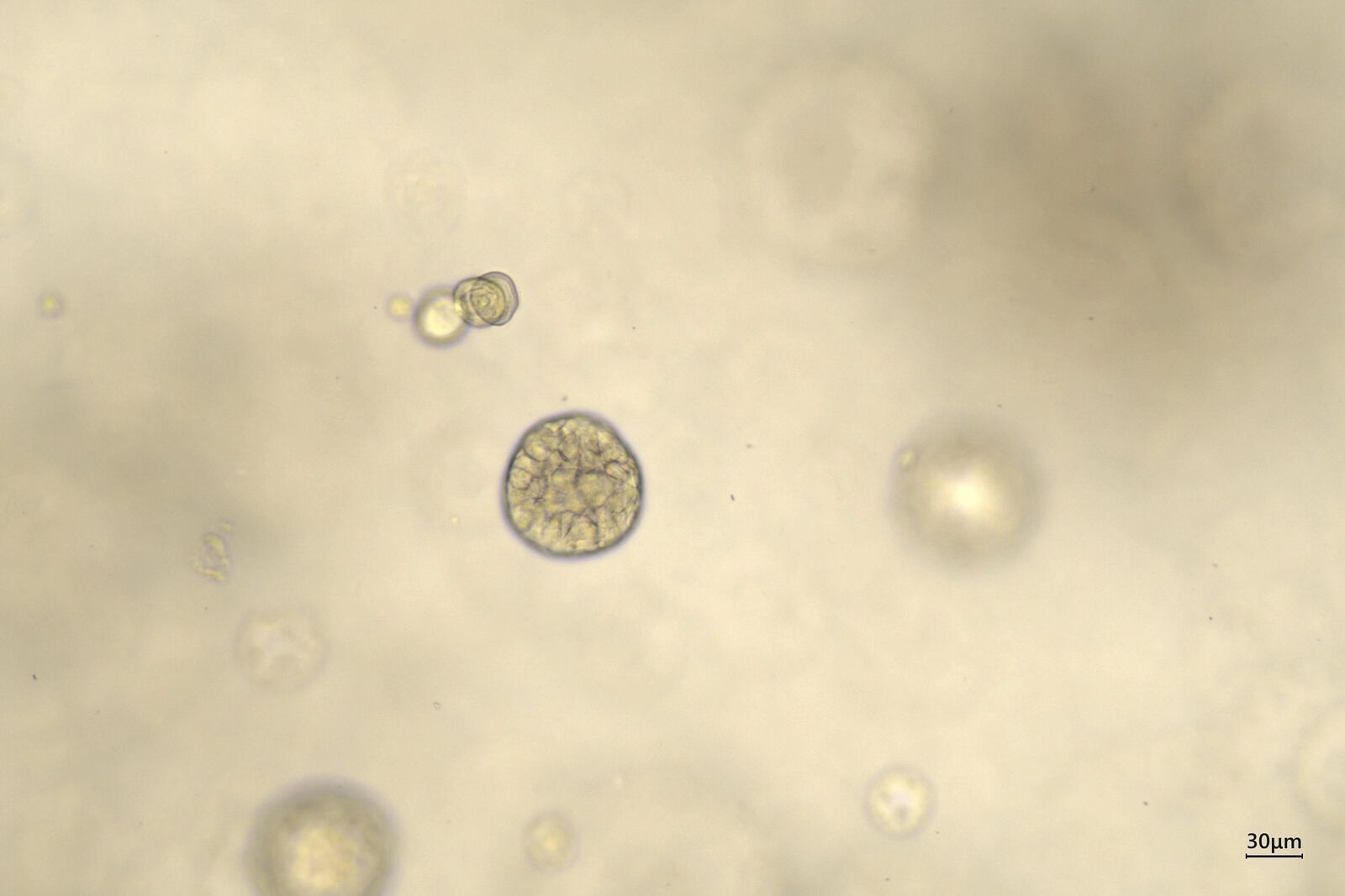 Overcoming Observational Challenges in Organoid 3D Cell Culture | Learn ...
