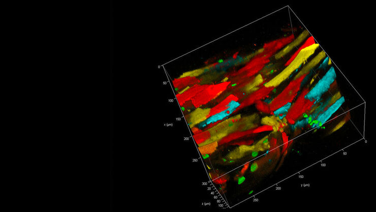 Confocal Microscopes | Products | Leica Microsystems