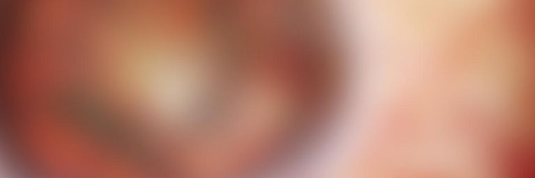 Proveo 8x 3D Digital Ophthalmic Microscope | Products | Leica Microsystems