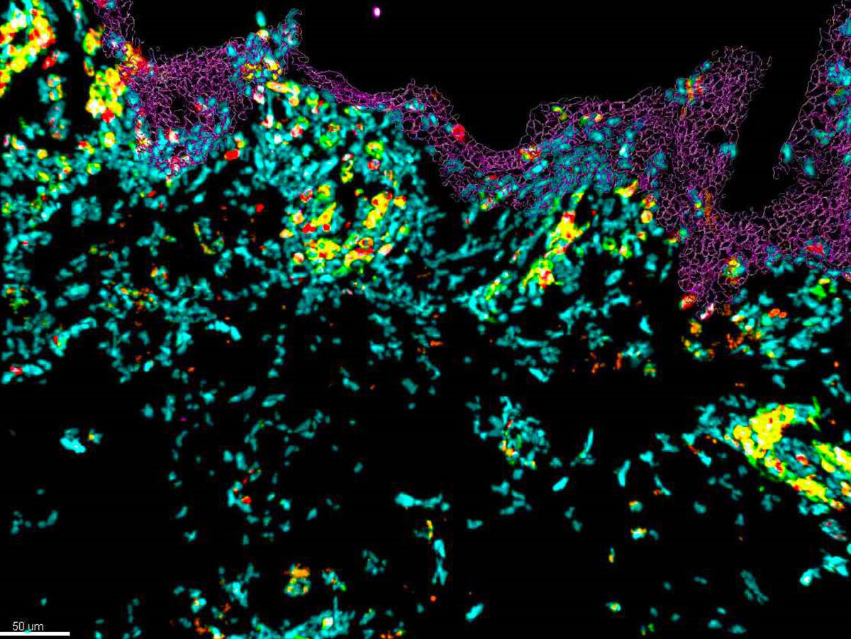 Confocal Imaging of Immune Cells in Tissue Samples | Learn & Share ...