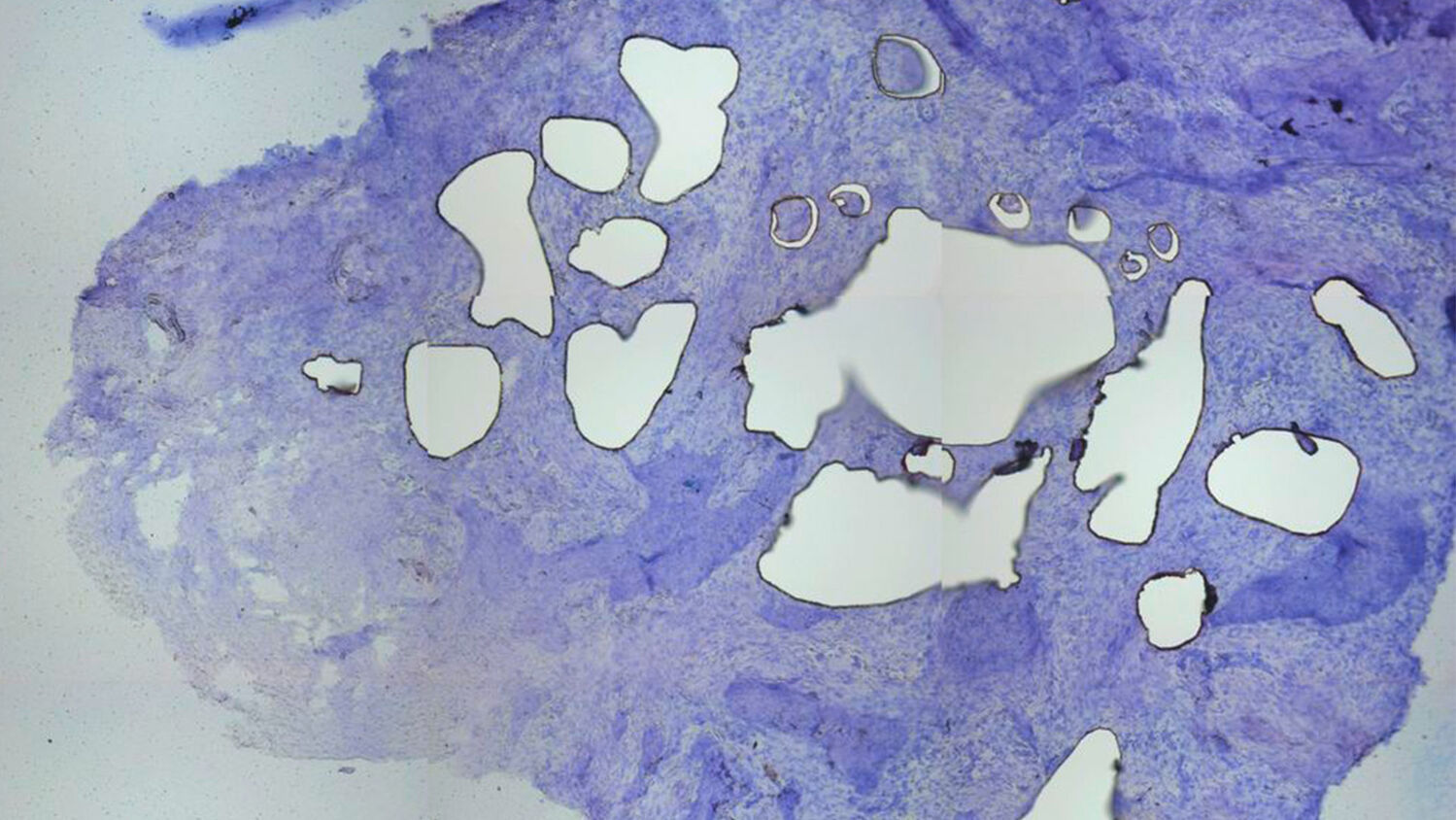 Microscopy in Pathology | Applications | Leica Microsystems