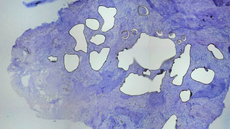 Microscopy in Pathology | Applications | Leica Microsystems