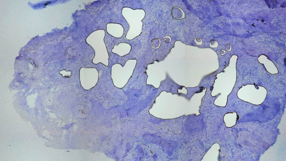 Microscopy in Pathology | Applications | Leica Microsystems