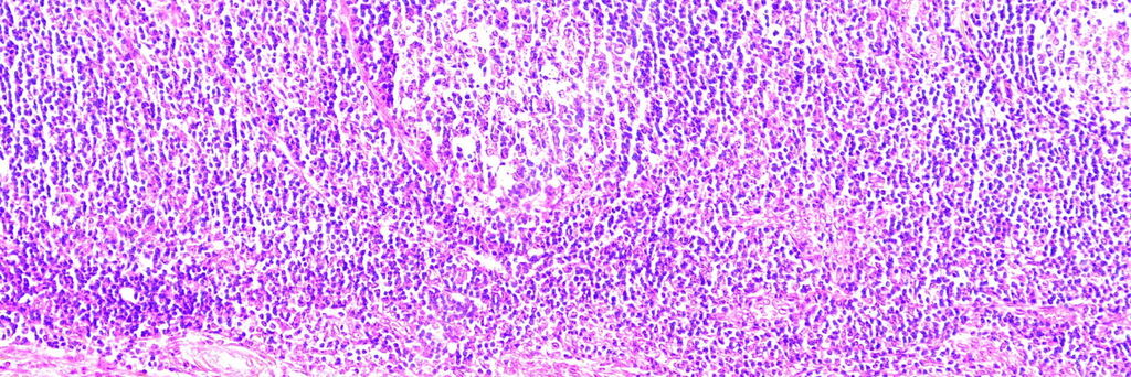 Clinical Pathology | Applications | Leica Microsystems