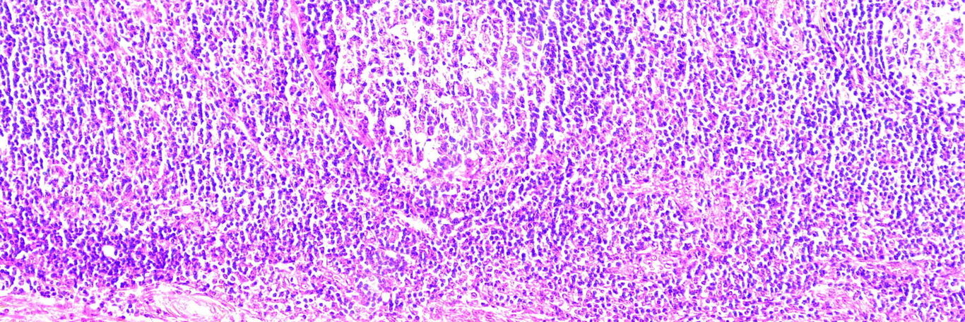 Clinical Pathology | Applications | Leica Microsystems