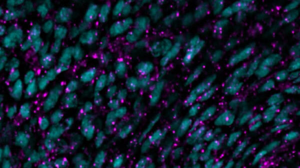THUNDER Imager Cell Spinning Disk | Products | Leica Microsystems