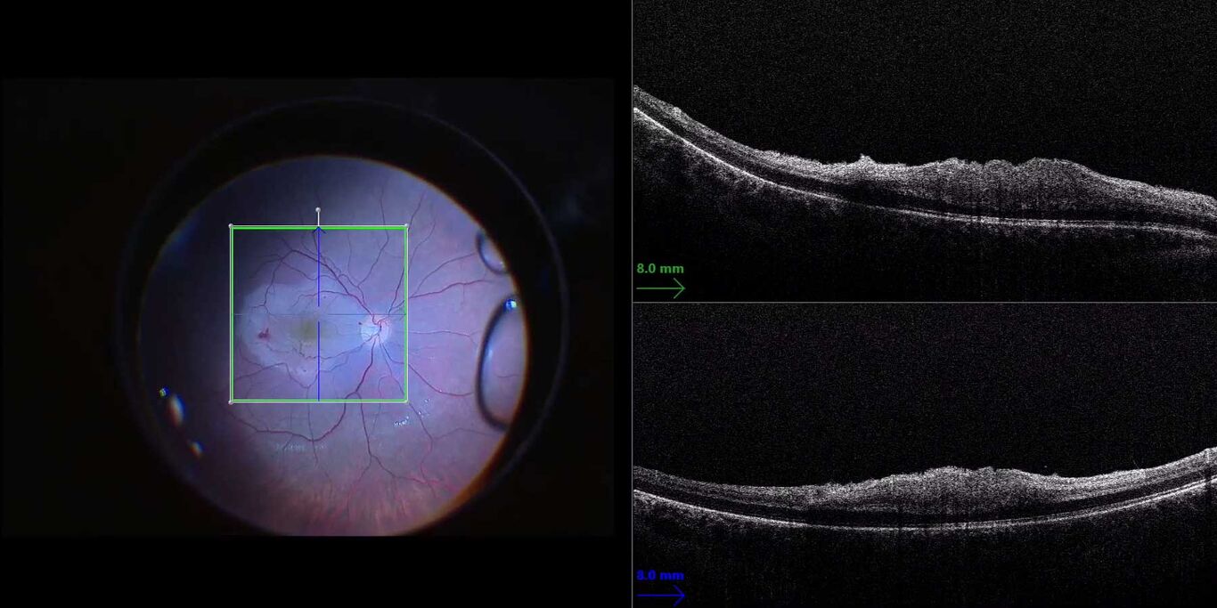 EnFocus Intraoperative OCT imaging system | Products | Leica Microsystems