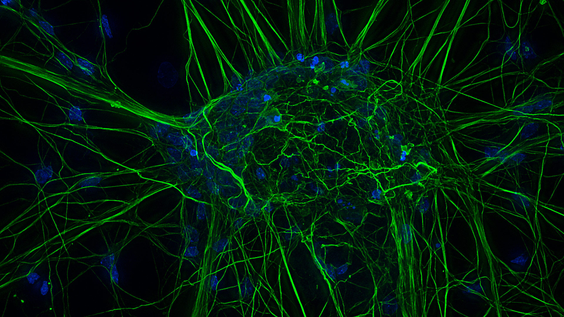 THUNDER Imaging Systems | Products | Leica Microsystems