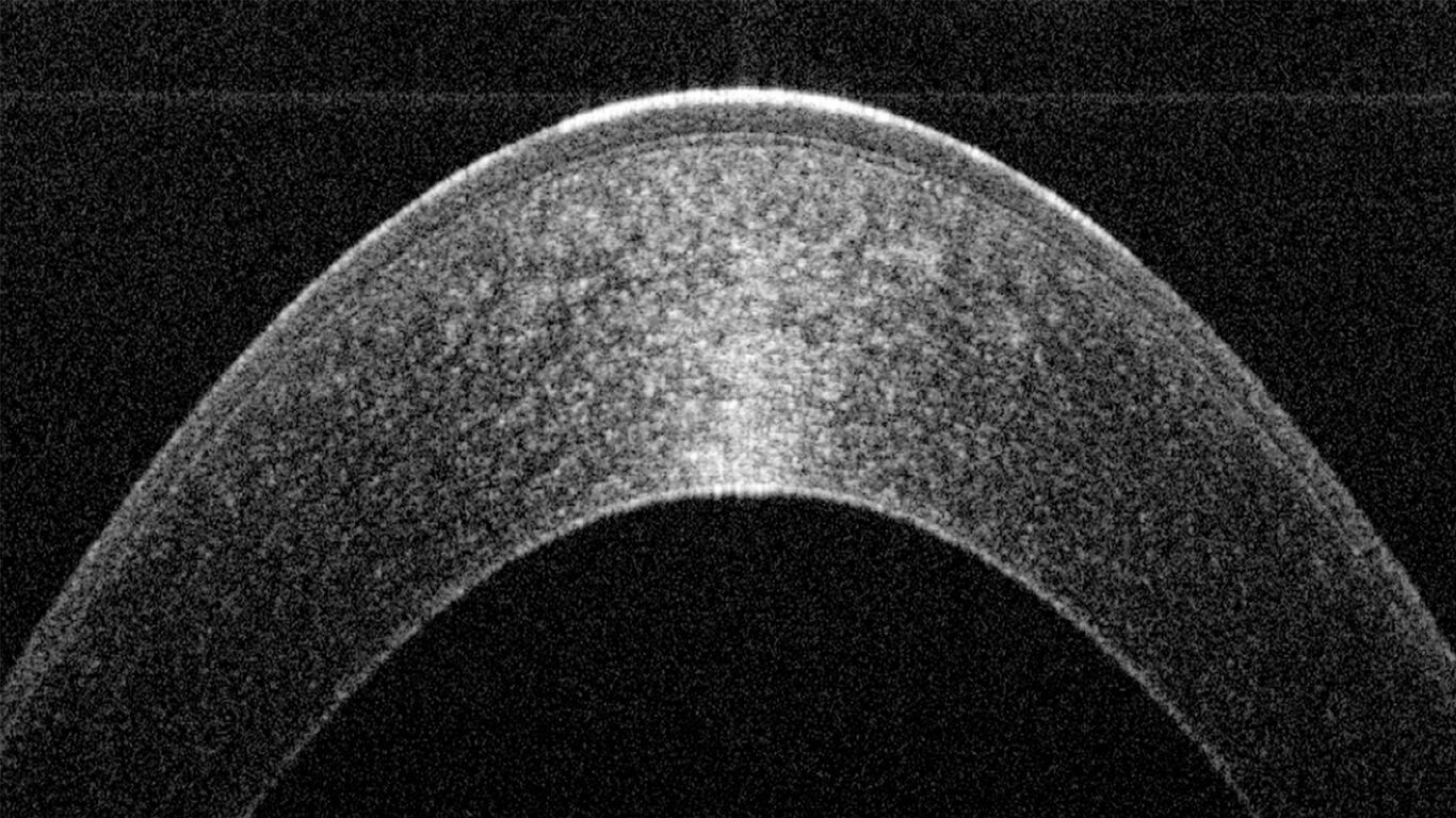 Surgical Microscopes | Products | Leica Microsystems