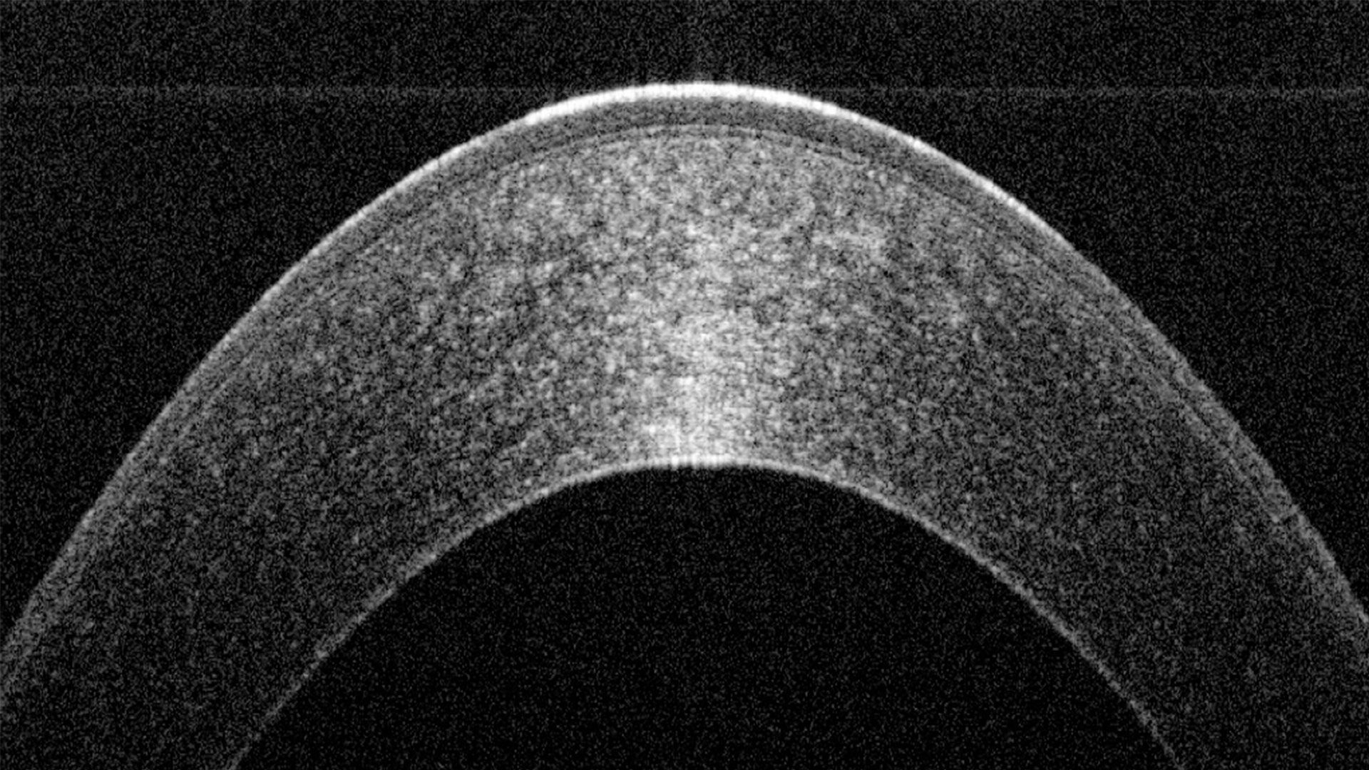 Surgical Microscopes | Products | Leica Microsystems