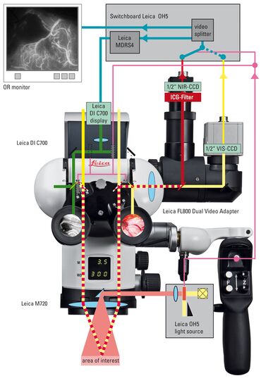 FL800 Intra-Operative Fluorescence-Guided Blood Flow View 820 nm/NIR - Media | Products | Leica ...