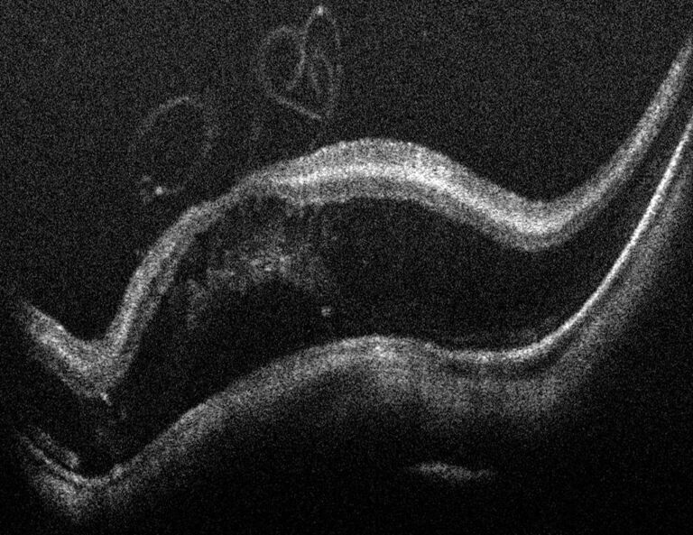 A Guide to OCT | Learn & Share | Leica Microsystems