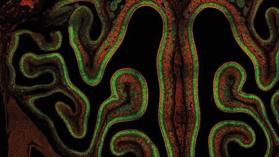 Confocal Microscopes | Products | Leica Microsystems