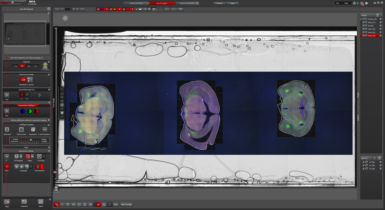 3D Tissue Imaging: From Fast Overview To High Resolution With One Click ...