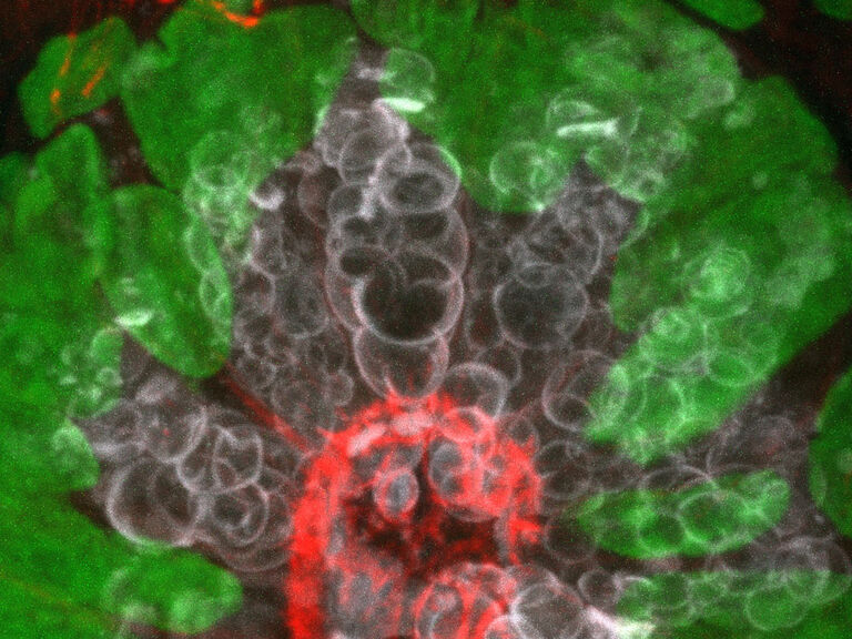 A Guide to Super-Resolution | Learn & Share | Leica Microsystems
