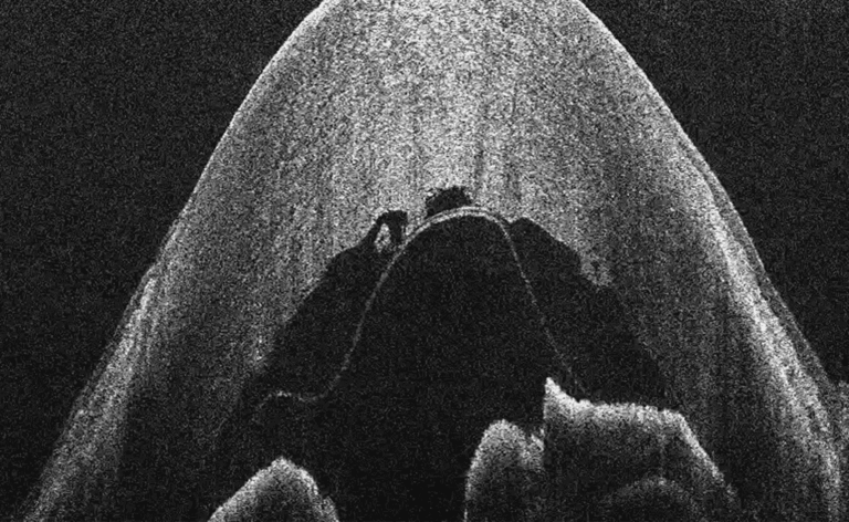 A Guide to OCT | Learn & Share | Leica Microsystems