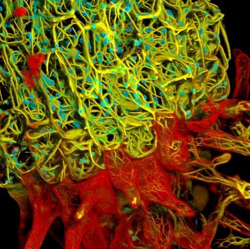 Confocal reimagined - STELLARIS - EMEA | Leica Microsystems