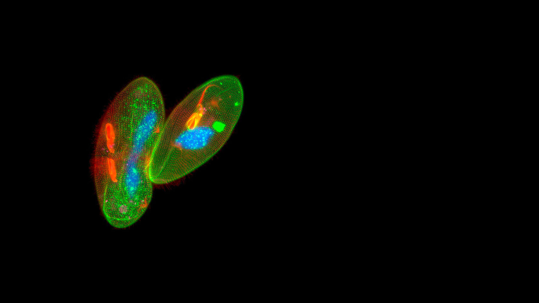 Microscope Cameras | Products | Leica Microsystems