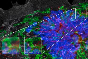 Webinars | Science Lab | Leica Microsystems