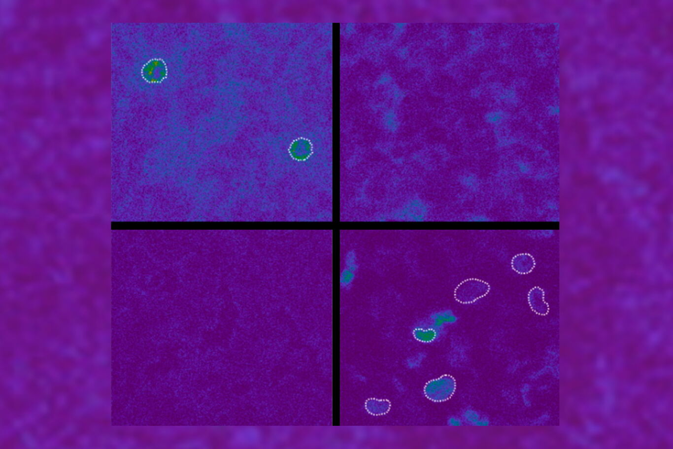 Spectroscopic Evaluation of Red Blood Cells | Learn & Share | Leica ...