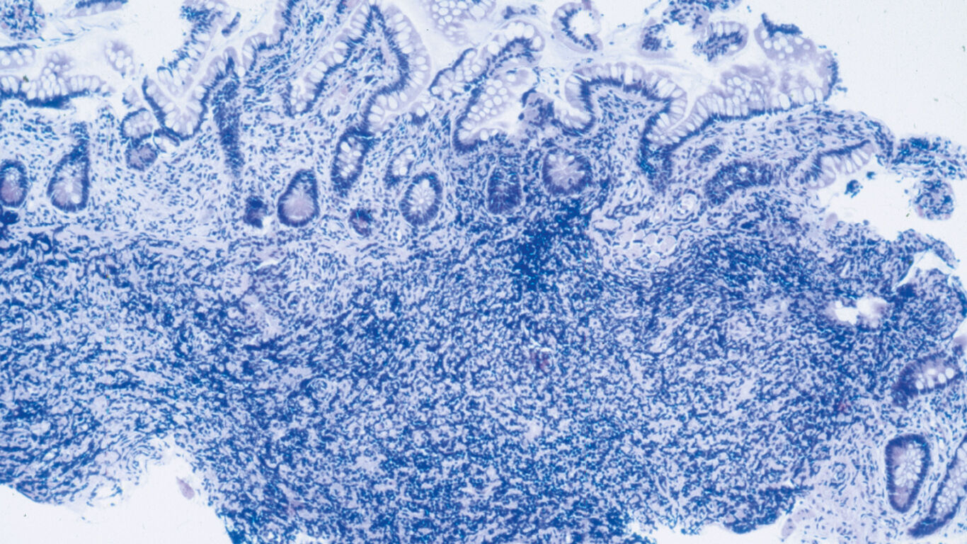 Clinical Pathology | Applications | Leica Microsystems