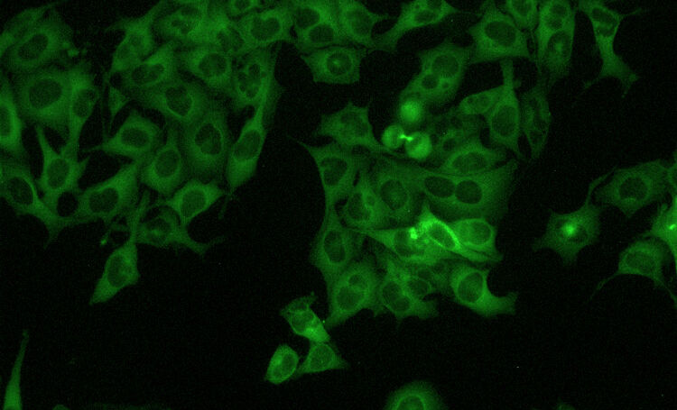 LED Fluorescence Light Sources | Products | Leica Microsystems