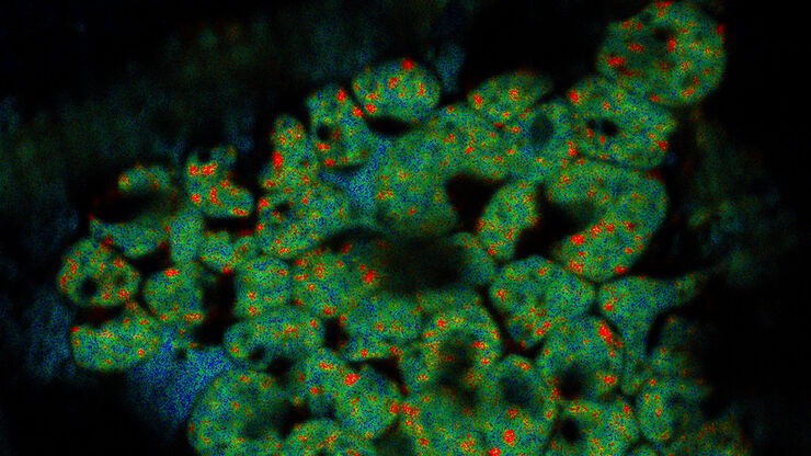 STELLARIS Cryo Confocal light microscope - Applications | Products | Leica Microsystems