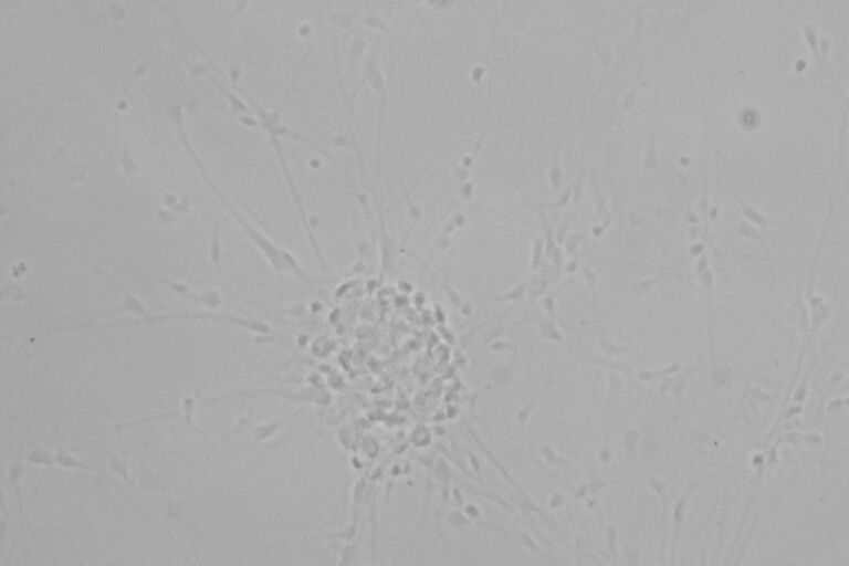Differential Interference Contrast (DIC) Microscopy | Learn & Share ...