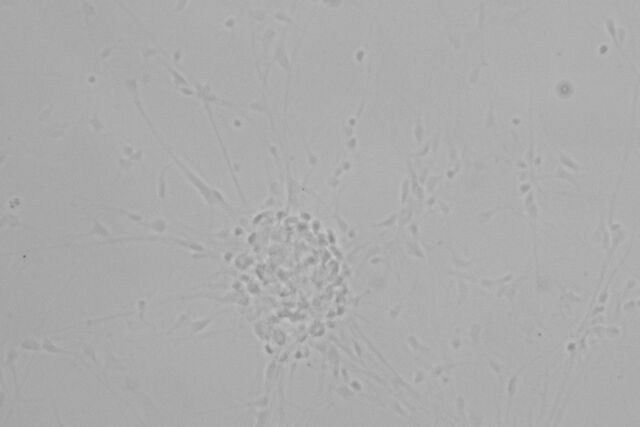 Differential Interference Contrast (DIC) Microscopy | Learn & Share ...