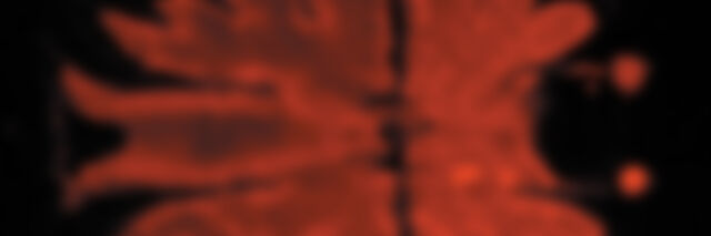 Leica DM3000 & DM3000 LED Uniquely Ergonomic System Microscopes With ...