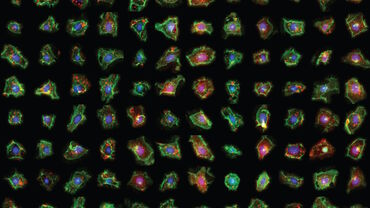 Leica LMD6 & LMD7 Laser Microdissection Microscopes - Applications ...