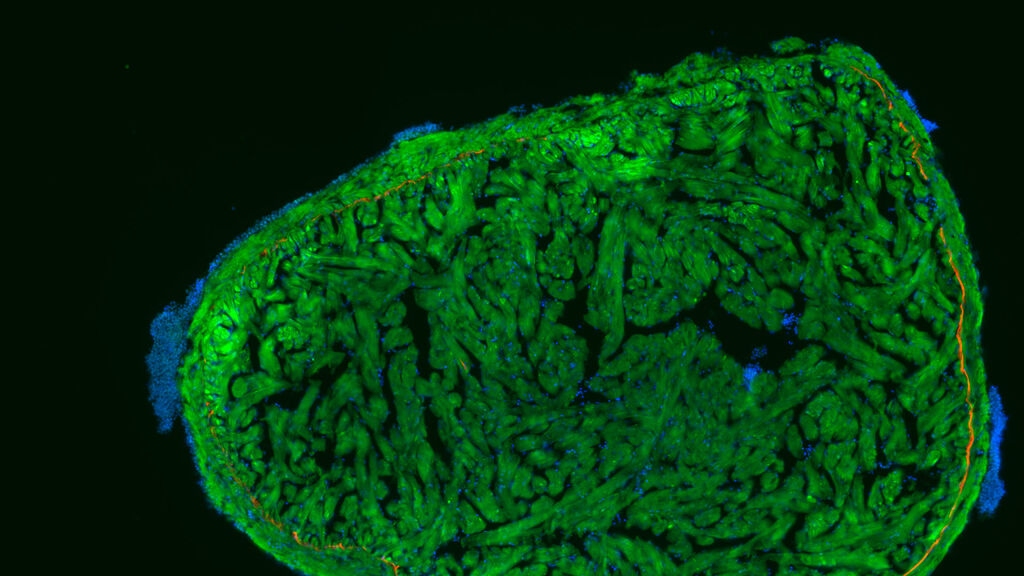 THUNDER Imaging Systems | Products | Leica Microsystems