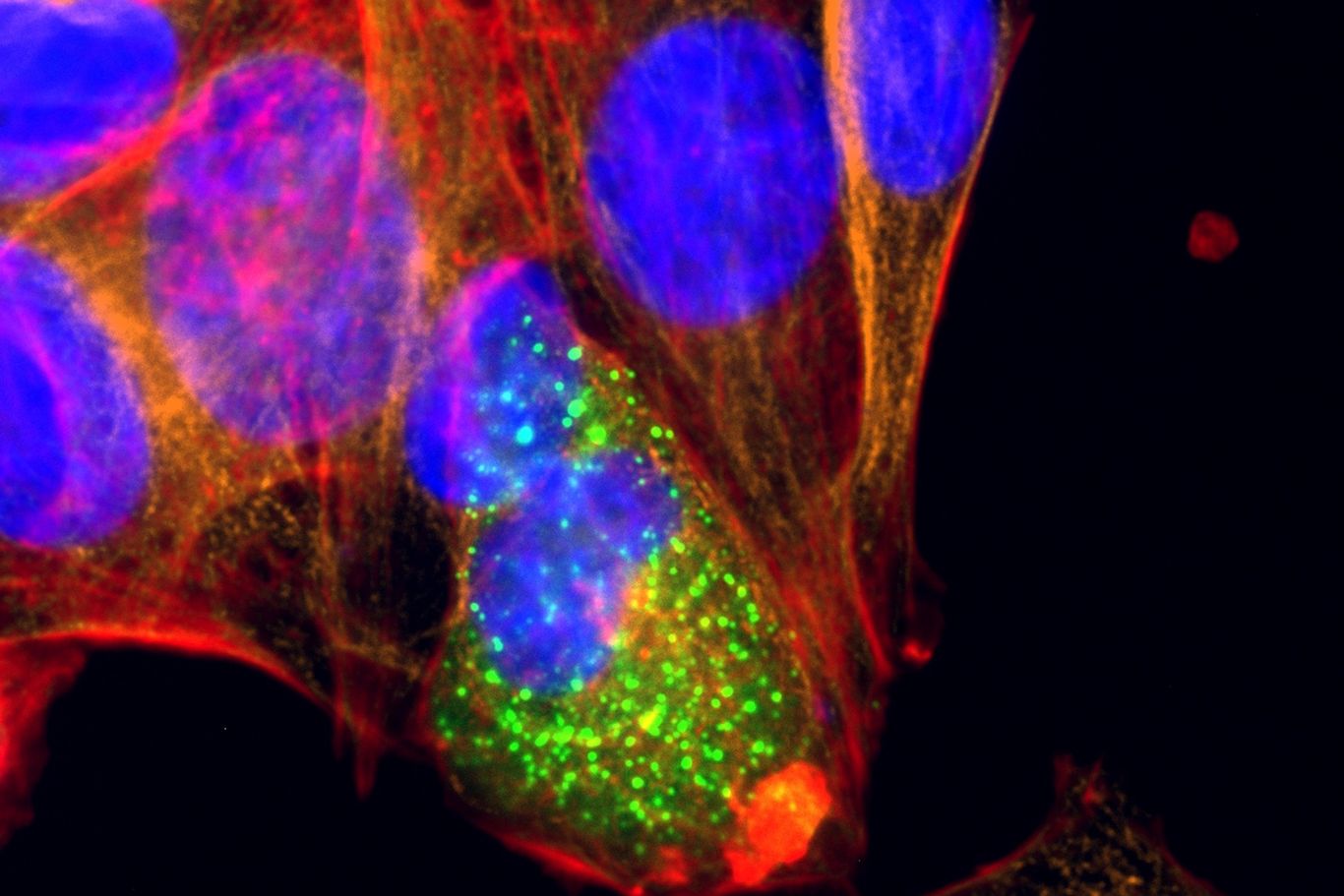 Microscopy and AI Solutions for 2D Cell Culture | Learn & Share | Leica ...