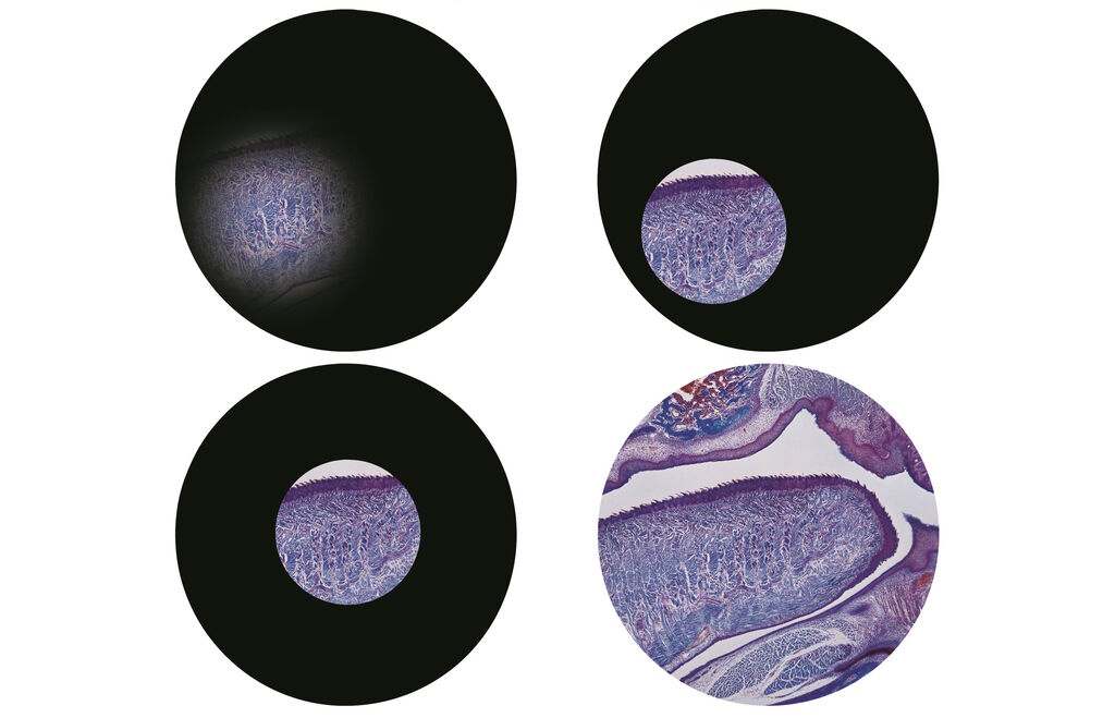 Koehler Illumination: A Brief History and a Practical Set Up in Five ...