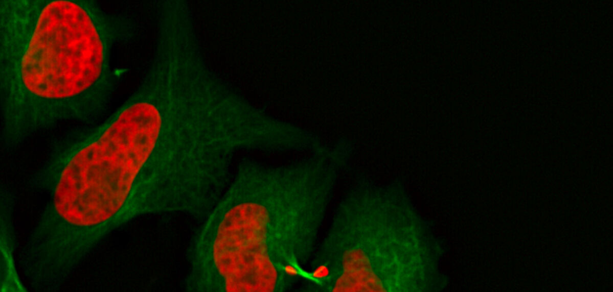 Correlative Light and Electron Microscopy (CLEM) | Applications | Leica ...