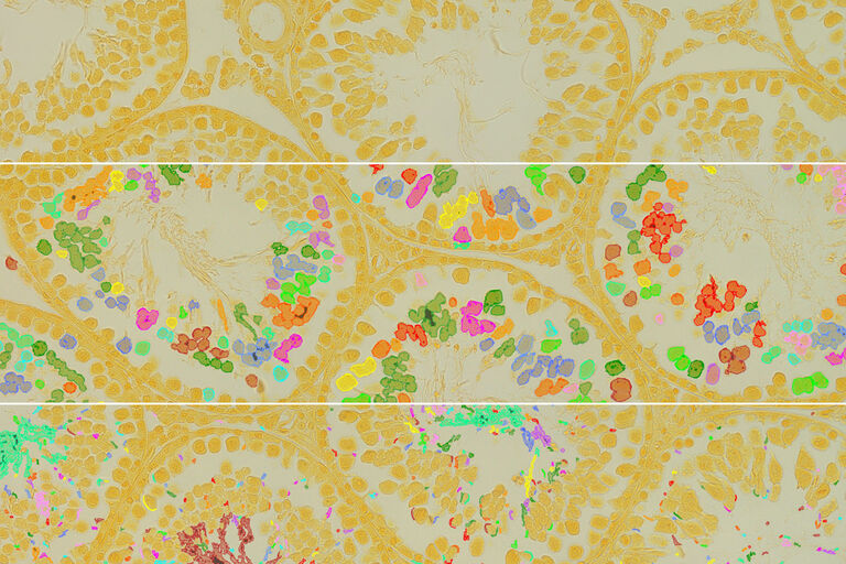 Leica LMD6 & LMD7 Laser Microdissection Microscopes | Products | Leica ...