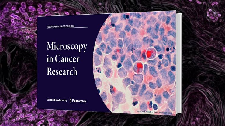 Microscopes and Imaging Systems | Leica Microsystems