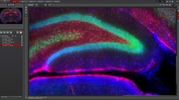 LAS X Life Science Mikroskop-Software-Plattform | Produkte | Leica ...