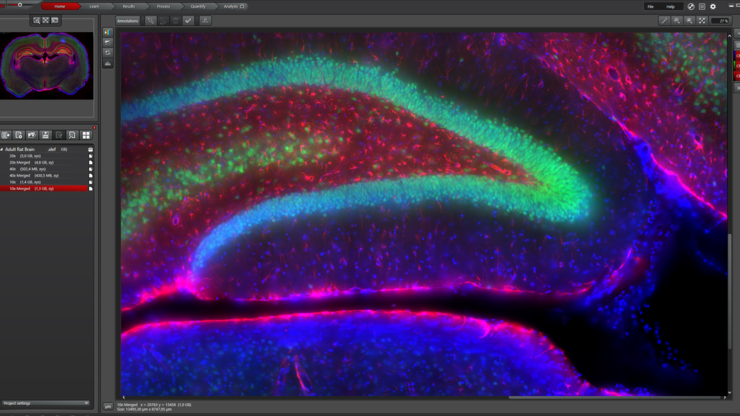 LAS X Life Science Mikroskop-Software-Plattform | Produkte | Leica ...