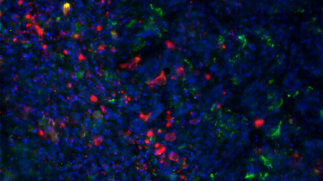 Inverted Microscopes | Products | Leica Microsystems