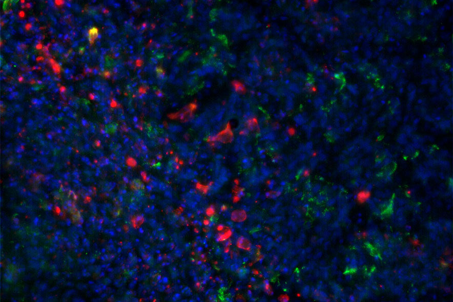 Inverted Microscopes | Products | Leica Microsystems