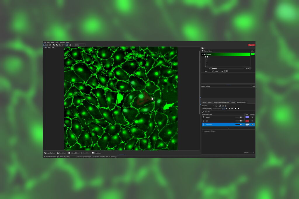 Using Machine Learning in Microscopy Image Analysis | Learn & Share ...