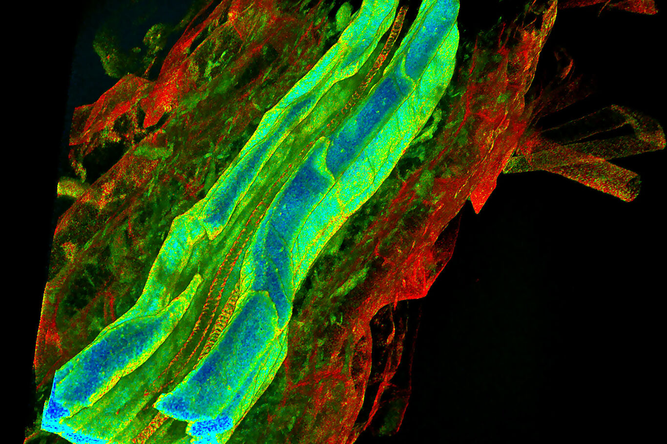 STELLARIS Confocal Microscope Platform | Products | Leica Microsystems